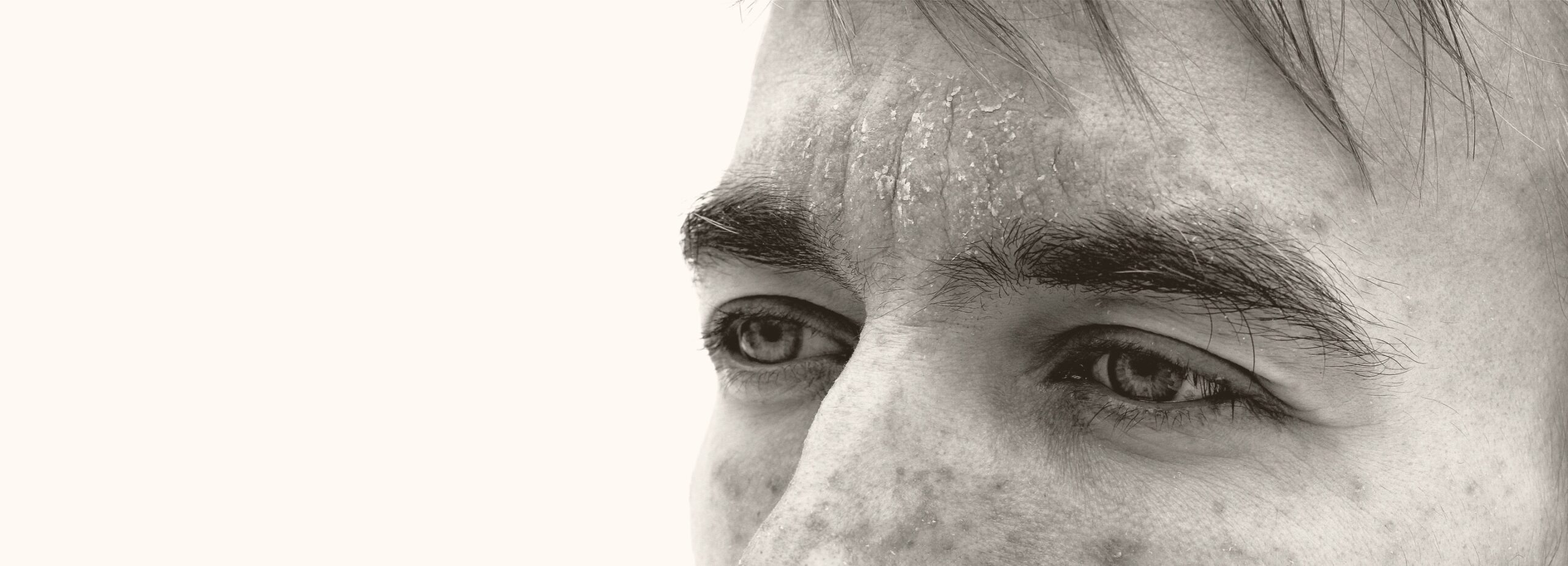 Patient Assistance Program | Arcutis Biotherapeutics