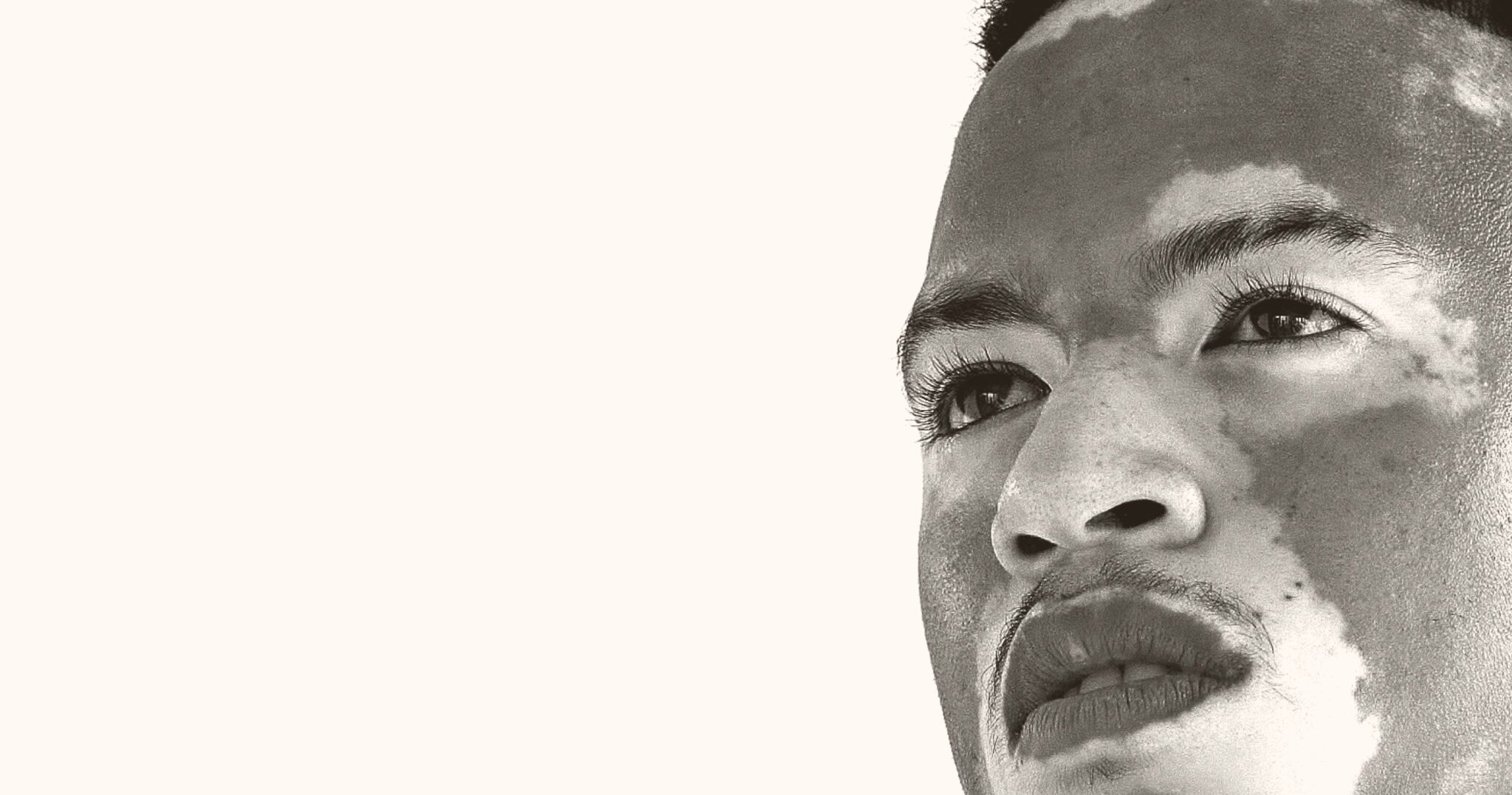 Medical dermatology innovation | Arcutis Biotherapeutics